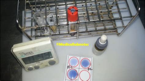 What Is Brucella Agglutination Test At Charles Dunaway Blog