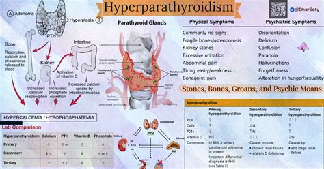 Hyperparathyroidism Medical Infographics
