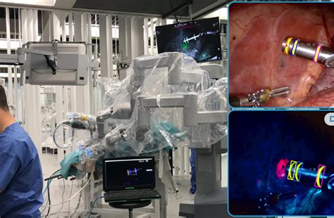 Arvr Visualizations And Surgical Navigation 3d Lab 3dlab Lumc