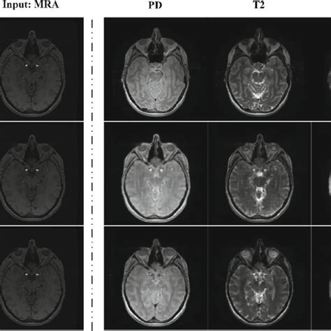 Pdf Unpaired Multi Contrast Mr Image Synthesis Using Generative