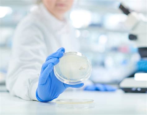 Stool C Difficile Toxin