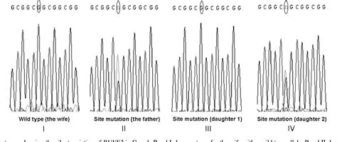 figure 1 from runx2 mutations in chinese patients with cleidocranial