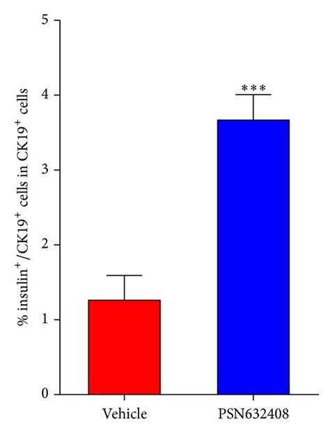 A Immunofluorescent Staining For Insulin Red Color And Ck19 Green