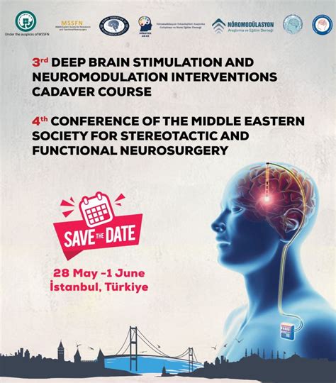 Patric Blomstedt On Linkedin Dbs And Scs Cadaver Course Istanbul 28 May 1 June 2025 Dont