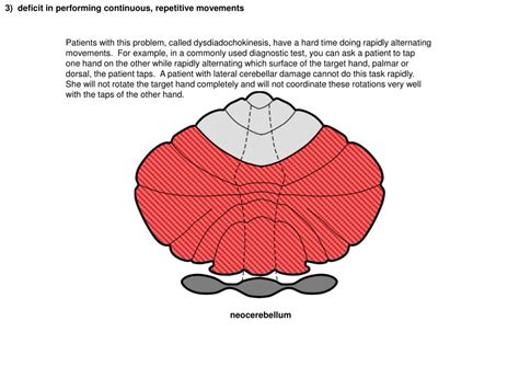 Ppt Cerebellar Function Powerpoint Presentation Free Download Id 4406538