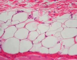 Tissues Lab Flashcards Quizlet Tissues Lab Flashcards Quizlet