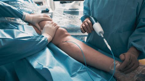 Venous Reflux Disease Symptoms And Treatment