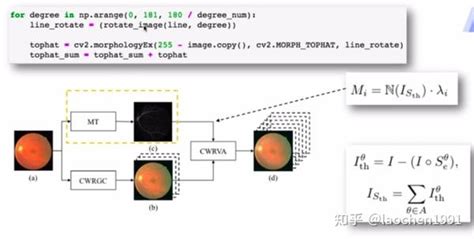 眼底血管分割数据集drive 知乎