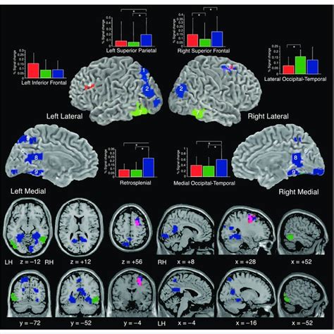 Pdf Reference Frames For Spatial Cognition Different Brain Areas Are Involved In Viewer