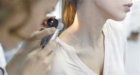 Basal Cell Carcinoma And Genetic Predisposition 24genetics