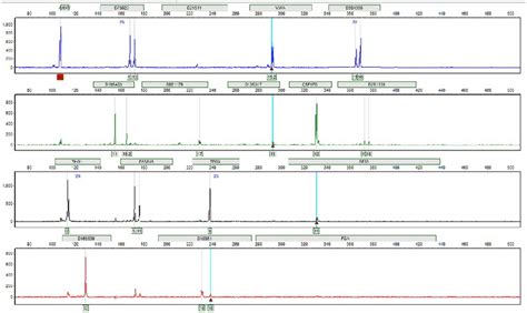 The Str Profiling Of The Bag50 Cell Line Download Scientific Diagram The Str Profiling Of The Bag50 Cell Line Download Scientific Diagram