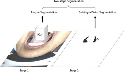 Two Stage Sublingual Veins Segmentation Strategy Download Scientific Diagram