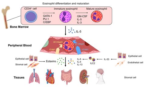 Jcm Free Full Text Eosinophilic Granulomatosis With Polyangiitis Latest Findings And