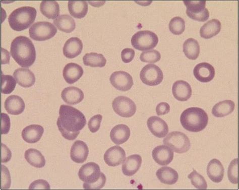 Gambar Sel Eritrosit Koleksi Gambar