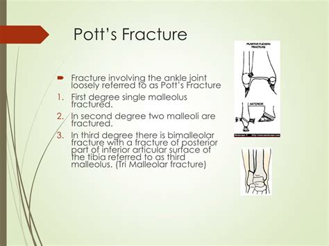 Ppt Ankle Joint Injuries And Management Overview Powerpoint