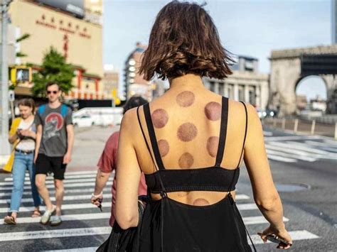 Cupping Therapy How Effective Is It Does It Have Any Side Effects Experts Tell Everything You