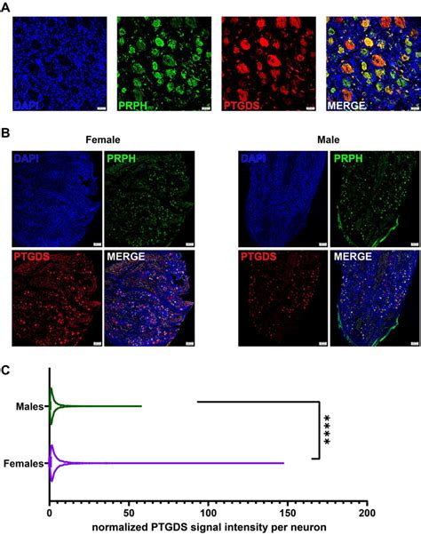 Ptgds Is Expressed In Human Drg Neurons A Confocal Images Show