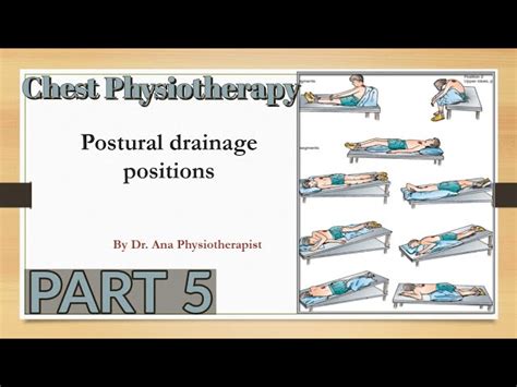 Postural Drainage Positions Pdf