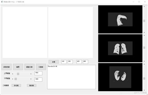 Ct图像分割python Ct图像分割及重建系统mob64ca14061c9e的技术博客51cto博客