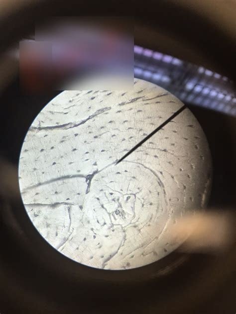 Bio 142 L Bone Cells Diagram Quizlet