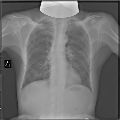 Yolov9diseasedirector Object Detection Dataset By Labelme2coco