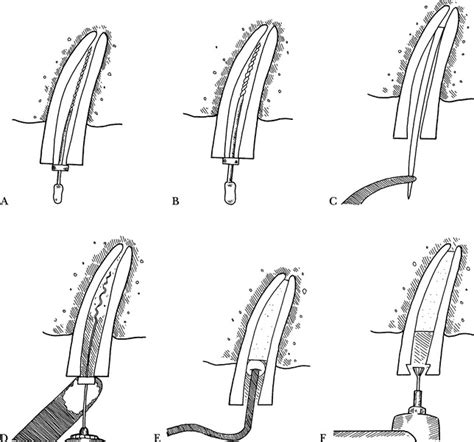 Endodontics Veterian Key