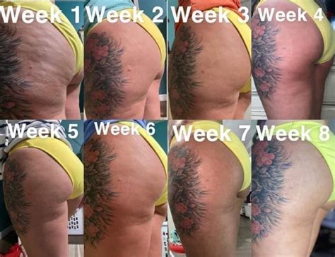 Pin On Dermatic Effects