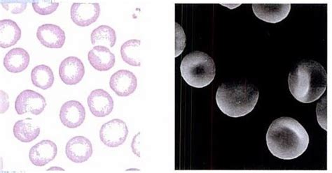 Células importantes en hematología ERITROCITO