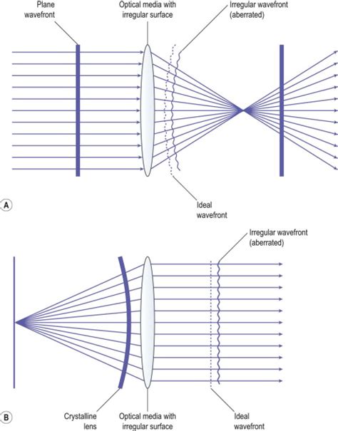 Optical Aberrations And Wavefront Sensing Ento Key