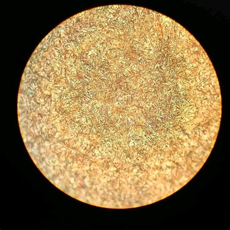 Opticalmicroscope Microstructure Micrograph Metallurgy Metallurgicalengineering