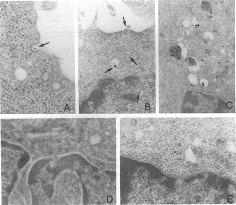 Visualization Of P Odn Uptake And Intracellular Trafficking By Electron Download Scientific