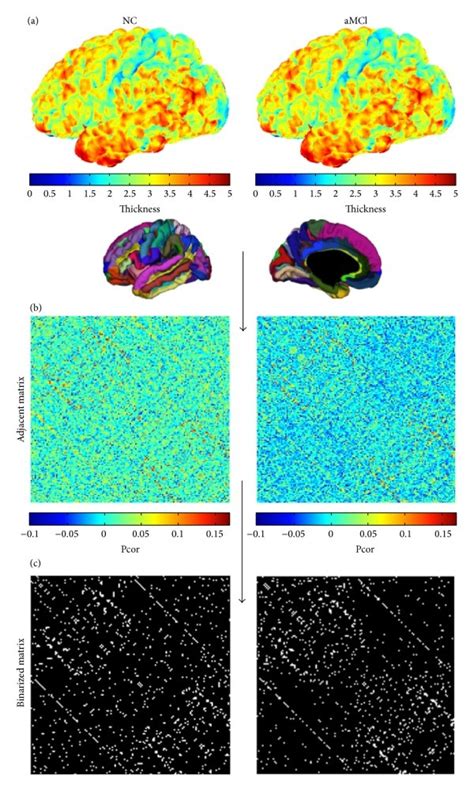 Flowchart For The Construction Of Structural Cortical Networks A Two Download Scientific