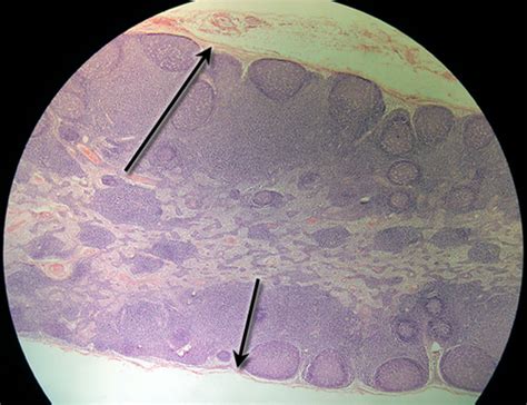 Lab Quiz Lymphatic System And Immunity Flashcards Quizlet