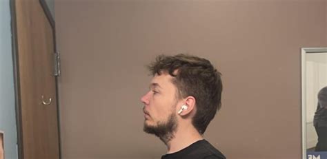 Feel Like My Overbitechin Ruins My Appearance Rmalegrooming