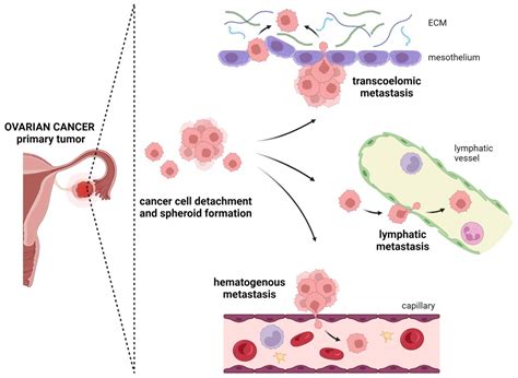 Ovarian Cancer Cells