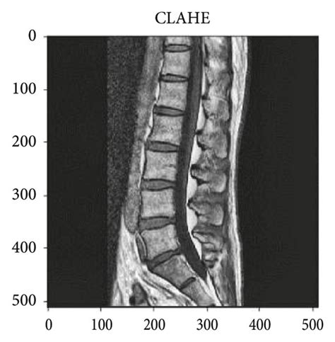 The Comparison Results Of Equalization A Original Graph B