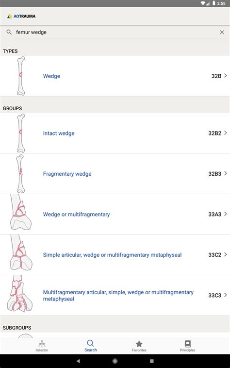 Aoota Fracture Classification Apk Pour Android Télécharger