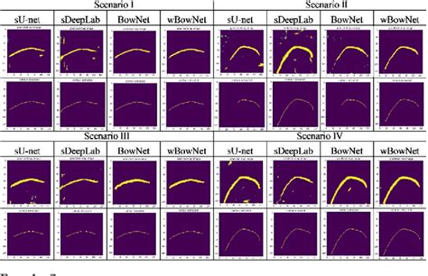 Figure 1 From Ultrasound Tongue Contour Extraction Using Dilated Convolutional Neural Network