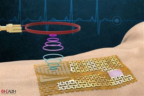 Mit Engineers Develop E Skin An Ultra Thin Wearable Health Monitoring Device Elets Ehealth