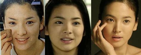 송혜교의 실체 숨길수 없는 성형증거들 스타 이런모습 네모판