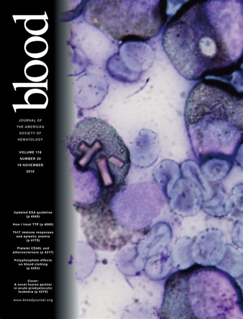 Contributions Of Trail Mediated Megakaryocyte Apoptosis To Impaired