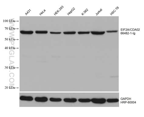 Eif2acda02 Antibody 66482 1 Pbs Proteintech