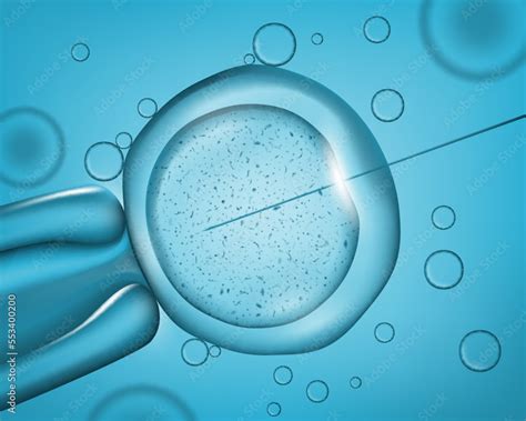 Laser Needle Injection To Cell Medical Operation Human Dna Research Biotechnology And