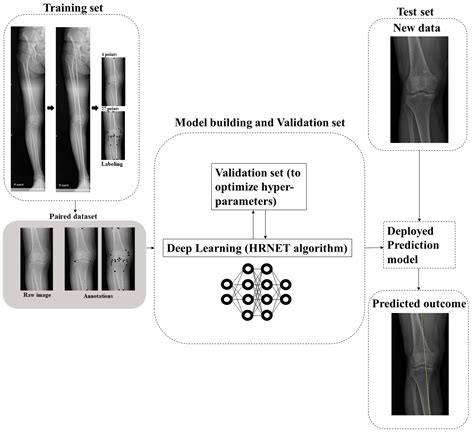 Key Point Detection Algorithm Of Deep Learning Can Predict Lower Limb