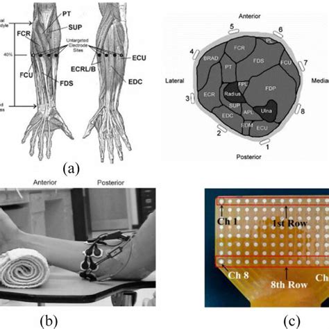 Surface Electromyography A Relationship Between Gesture And Forearm Download Scientific