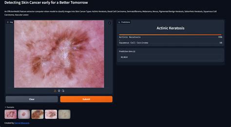 Detector Devpost Detector Devpost