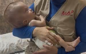 War And Famine Fuel Rise In Birth Defects In Gaza