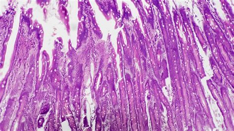 Section Of Human Sensory Cortex Filmed Under Microscope 200x On Bright Field Stock Footage