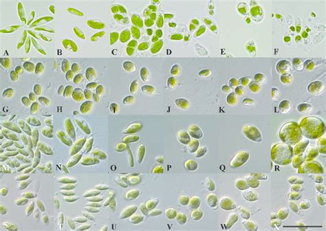 Phenotypic Plasticity Of Various Coccomyxa Strains Under Different Download Scientific Diagram