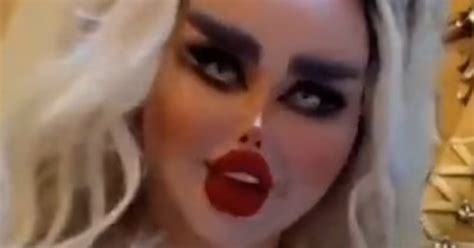 Woman Has 43 Surgeries To Look Like A Doll But She Looks Like A Zombie